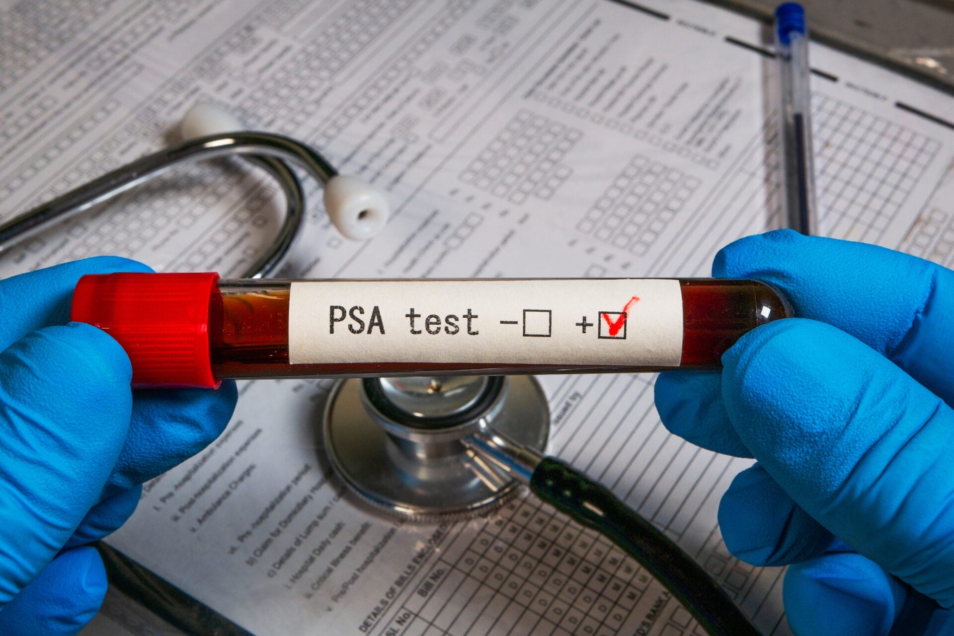Prostate Cancer Screening Guide Men | Early Detection